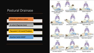 Fisioterapi Dada.pptx