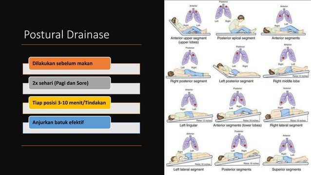 Fisioterapi Dada.pptx