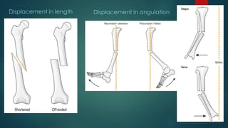 Konsep Fraktur | PDF