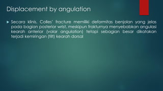 Konsep Fraktur | PDF