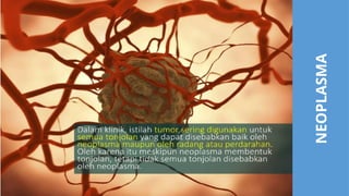 KONSEP PENGANTAR NEOPLASMA._KONSEP PENGANTAR NEOPLASMA | PPTX