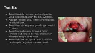 Konsiderasi Anestesia pada Tonsilektomi.pptx