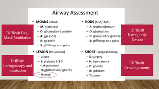KONSIDERASI DIFFICULT AIRWAY 309 WO.pptx