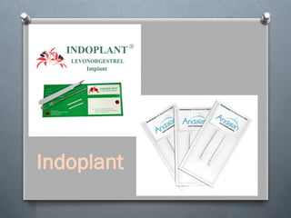 Alat Kontrasepsi Bawah Kulit (Implan).pptx