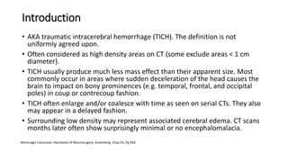Kontusio cerebri.pptx