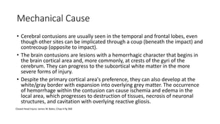 Kontusio cerebri.pptx