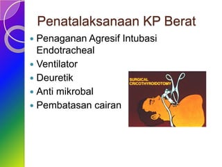 Kontusio paru | PPT