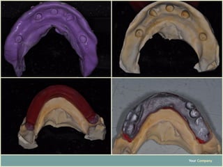 Konus attachment(6:28) | PDF