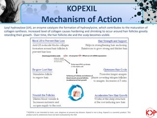 Kopexil 1ppt | PPTX