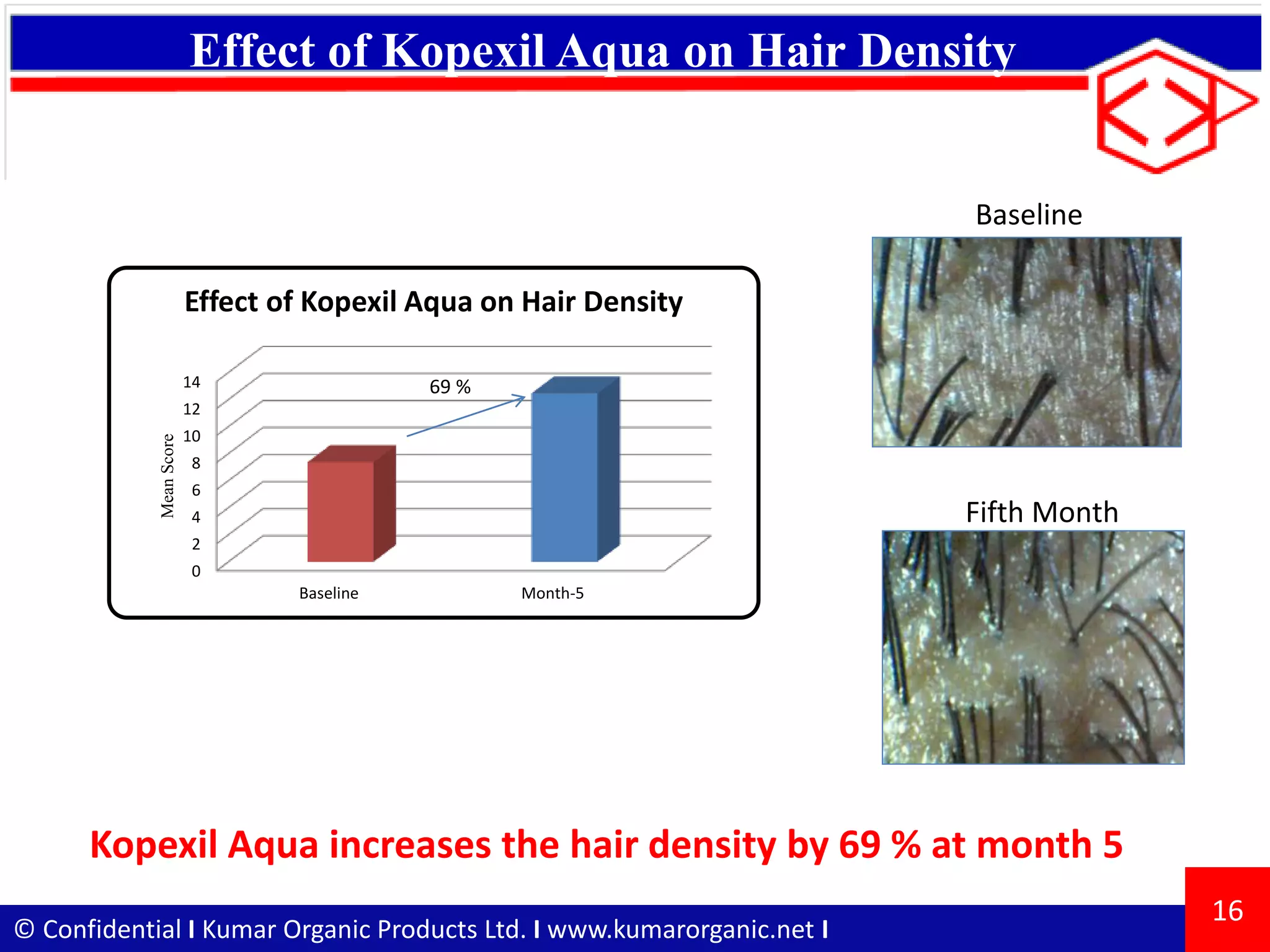 Kopexil aqua- 100 % water soluble hair growth stimulant | PPTX