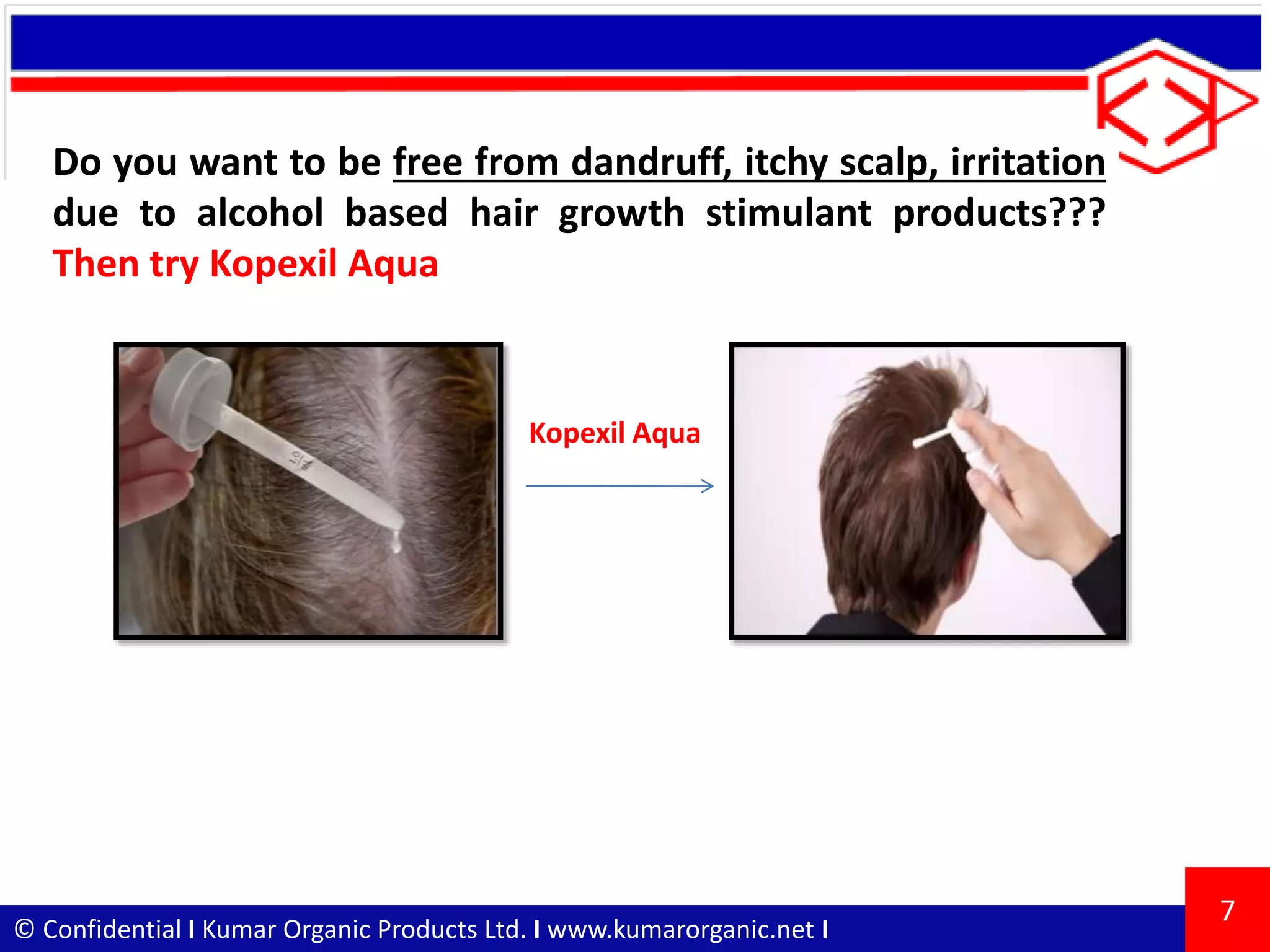 Kopexil aqua- 100 % water soluble hair growth stimulant | PPTX