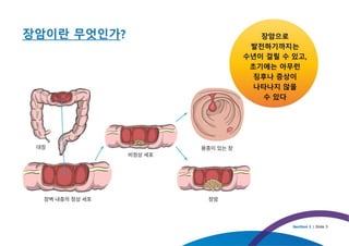 Bowel health and screening flipchart (Korean) | PPTX