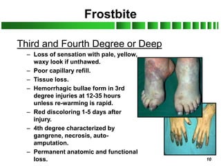 Korea_Soldiers_Guide_to_Prevent_Cold_Weather_Injuries.ppt