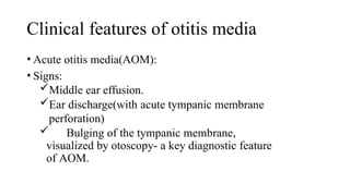 KORESH acute and chronic otitis media PPT.pptx