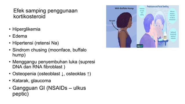 Penggunaan Kortikosteroid dalam Kehidupan Sehari | PPTX