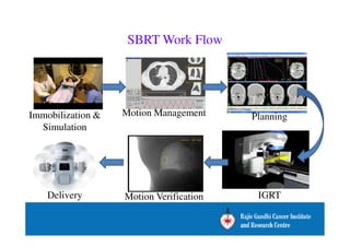 SRS & SBRT - Unflattened Beam | PDF