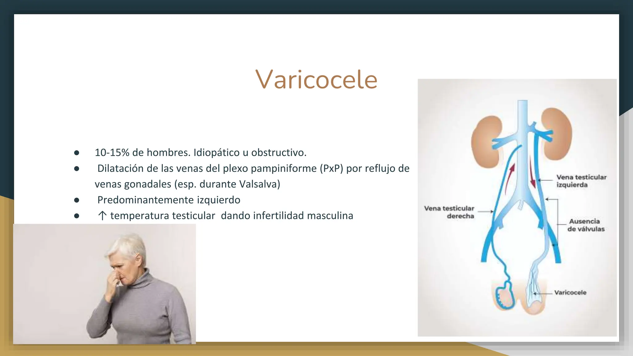 HIDROCELE Y VARICOCELE EN IMAGENOLOGIA RADIOLOGICA | PPT