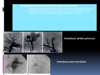 [KP 2.2.4.2] Hemoptisis Masif, Emboli Paru, Infark Paru.pptx