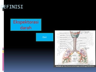 [KP 2.2.4.2] Hemoptisis Masif, Emboli Paru, Infark Paru.pptx