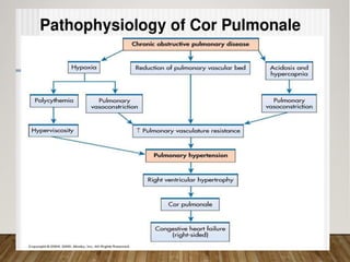cor pulmonale for humanity faculty medicine | PPTX