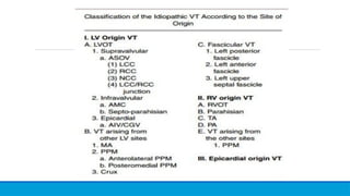 ECG -Ventricular tachycardia localisation .pptx