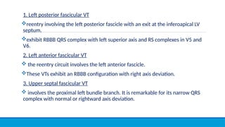 ECG -Ventricular tachycardia localisation .pptx