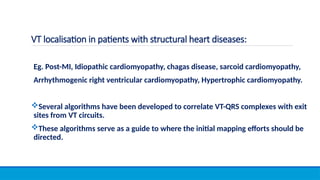 ECG -Ventricular tachycardia localisation .pptx