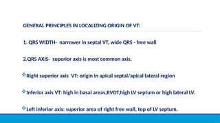 ECG -Ventricular tachycardia localisation .pptx