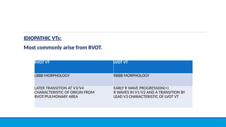 ECG -Ventricular tachycardia localisation .pptx