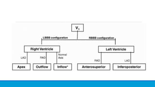 ECG -Ventricular tachycardia localisation .pptx
