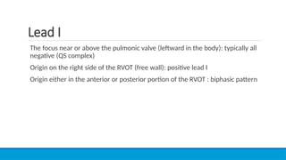 ECG -Ventricular tachycardia localisation .pptx