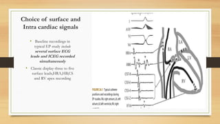 Basics of His bundle Electrogram.pptx