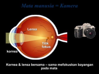 KP 30 KELAINAN AKOMODASI DAN REFRAKSI.pptx