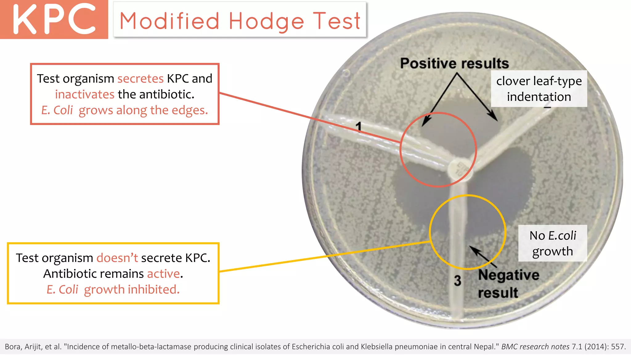 KPC (Klebsiella pneumoniae carbapenamases) | PDF