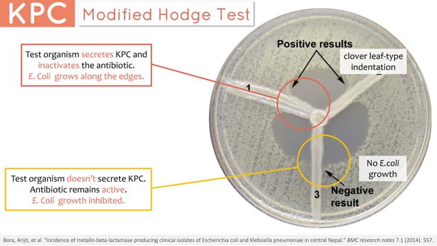 KPC (Klebsiella pneumoniae carbapenamases) | PDF