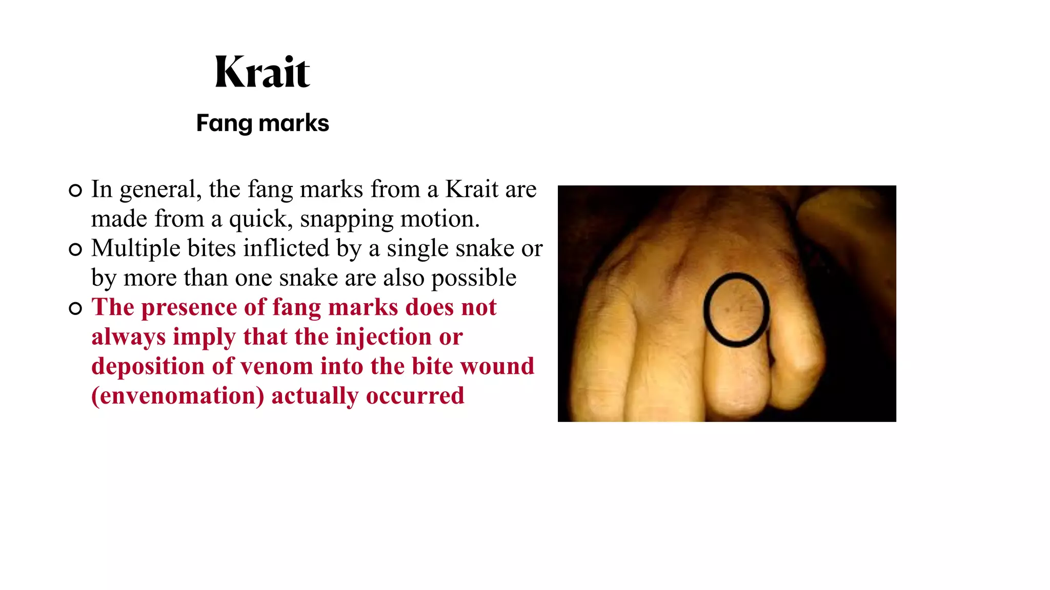 Krait : Envenomation | PDF