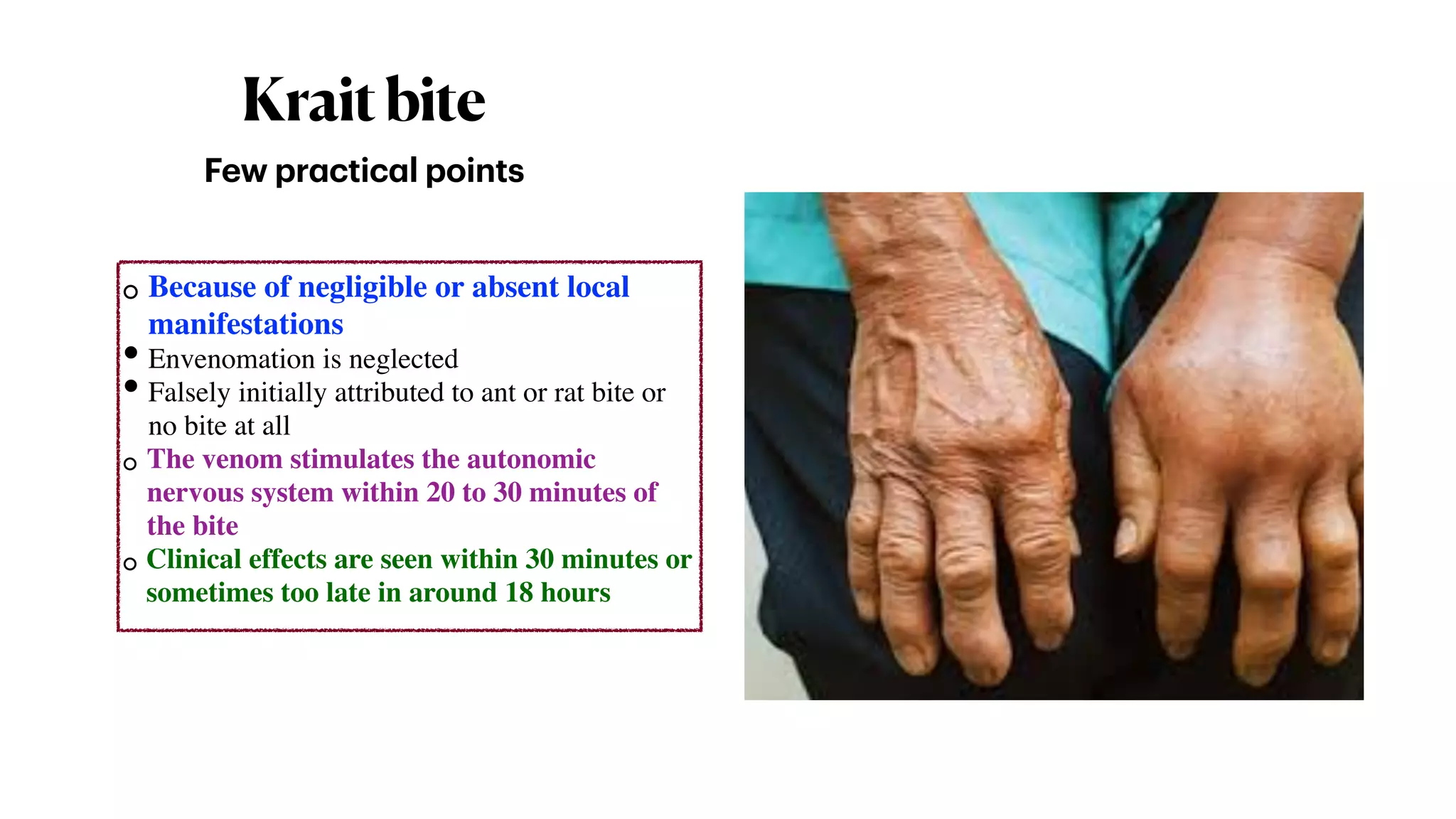 Krait : Envenomation | PDF