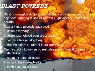 Kraš povrede | PPTX