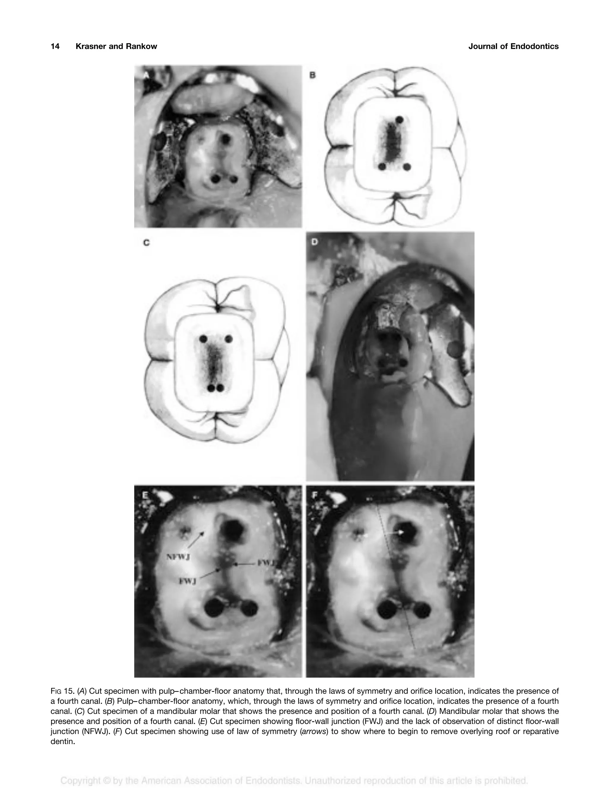 Anatomy of the Pulp-Chamber Floor | PDF