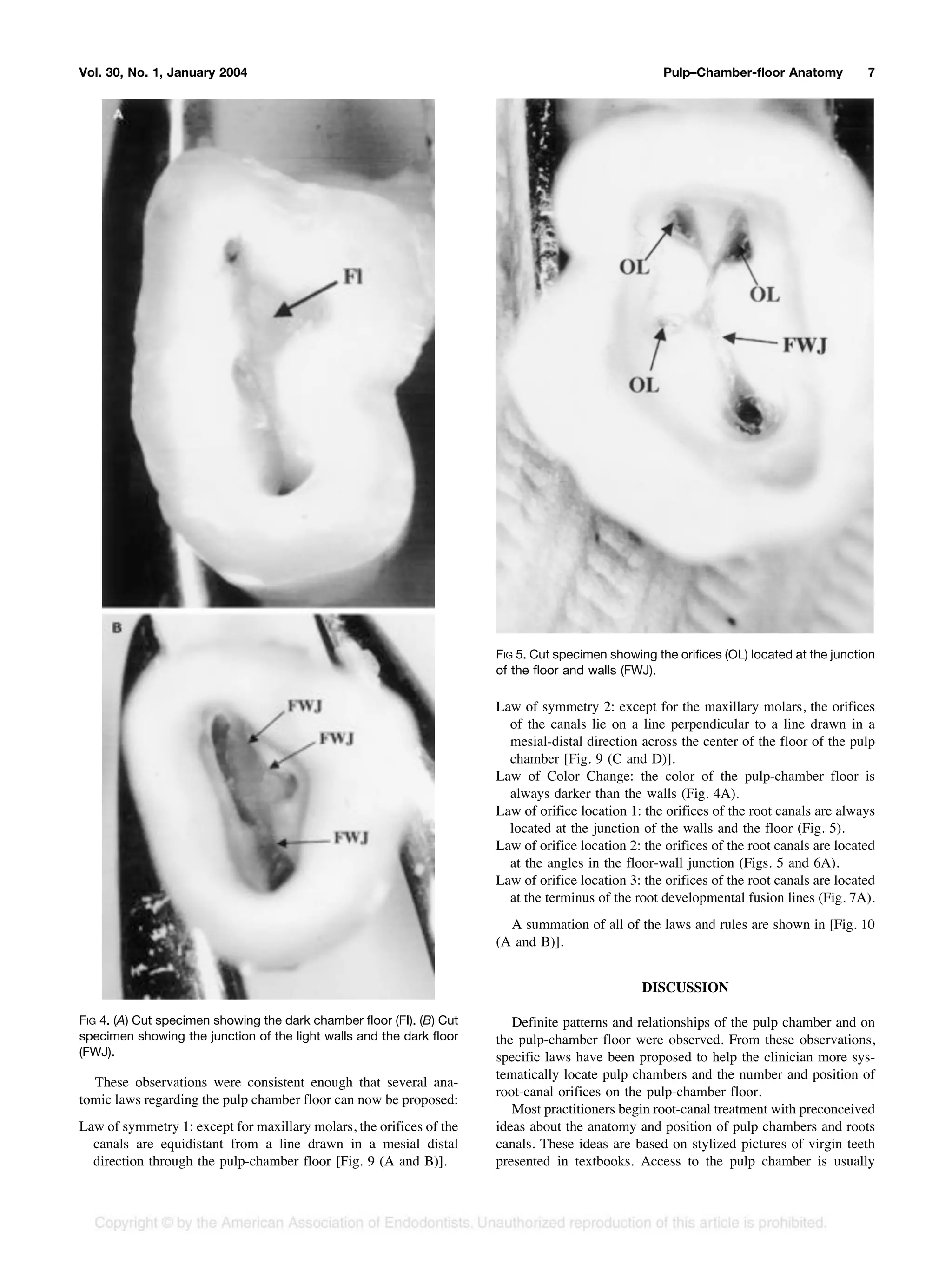Anatomy of the Pulp-Chamber Floor | PDF