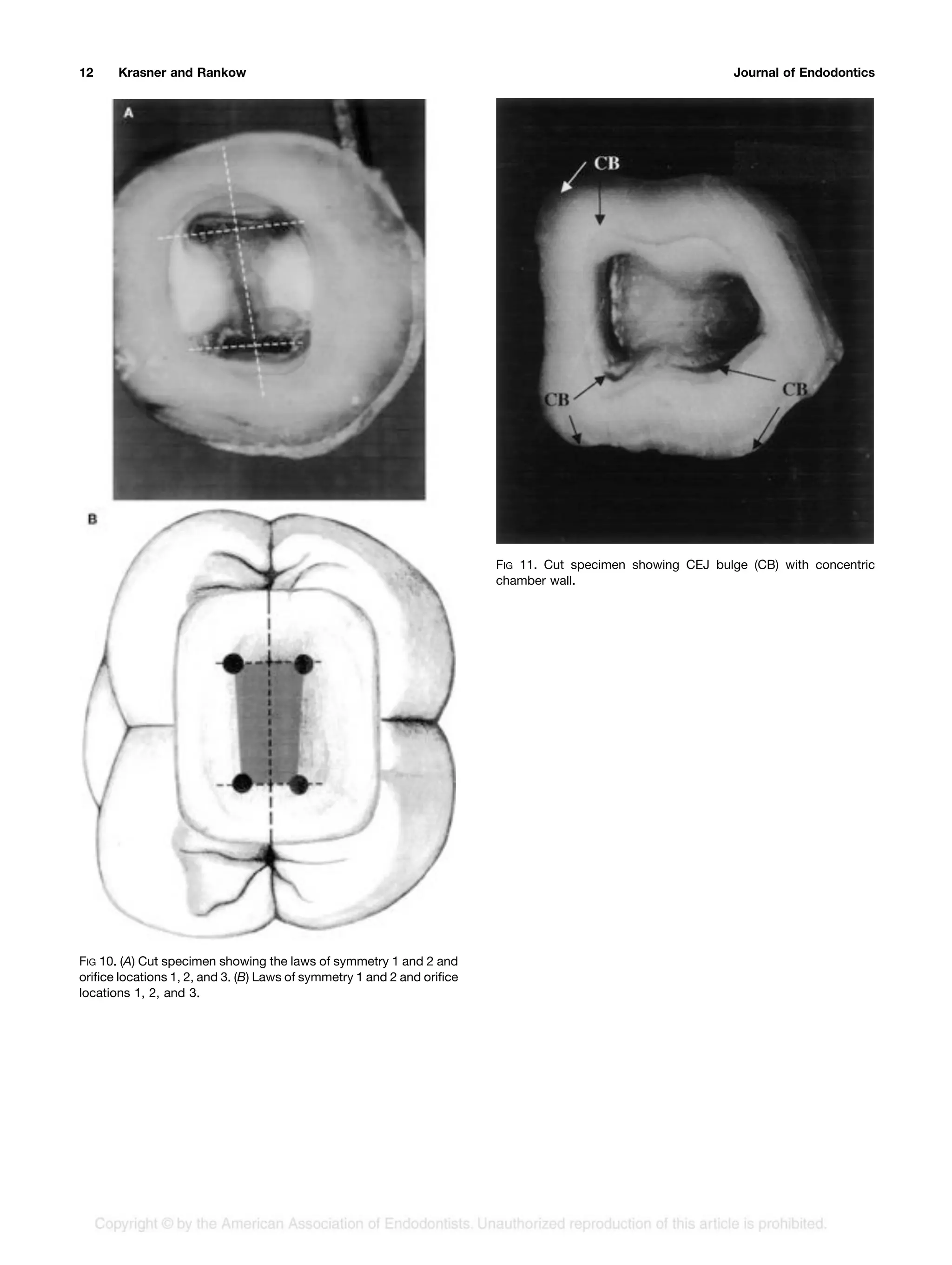 Anatomy of the Pulp-Chamber Floor | PDF