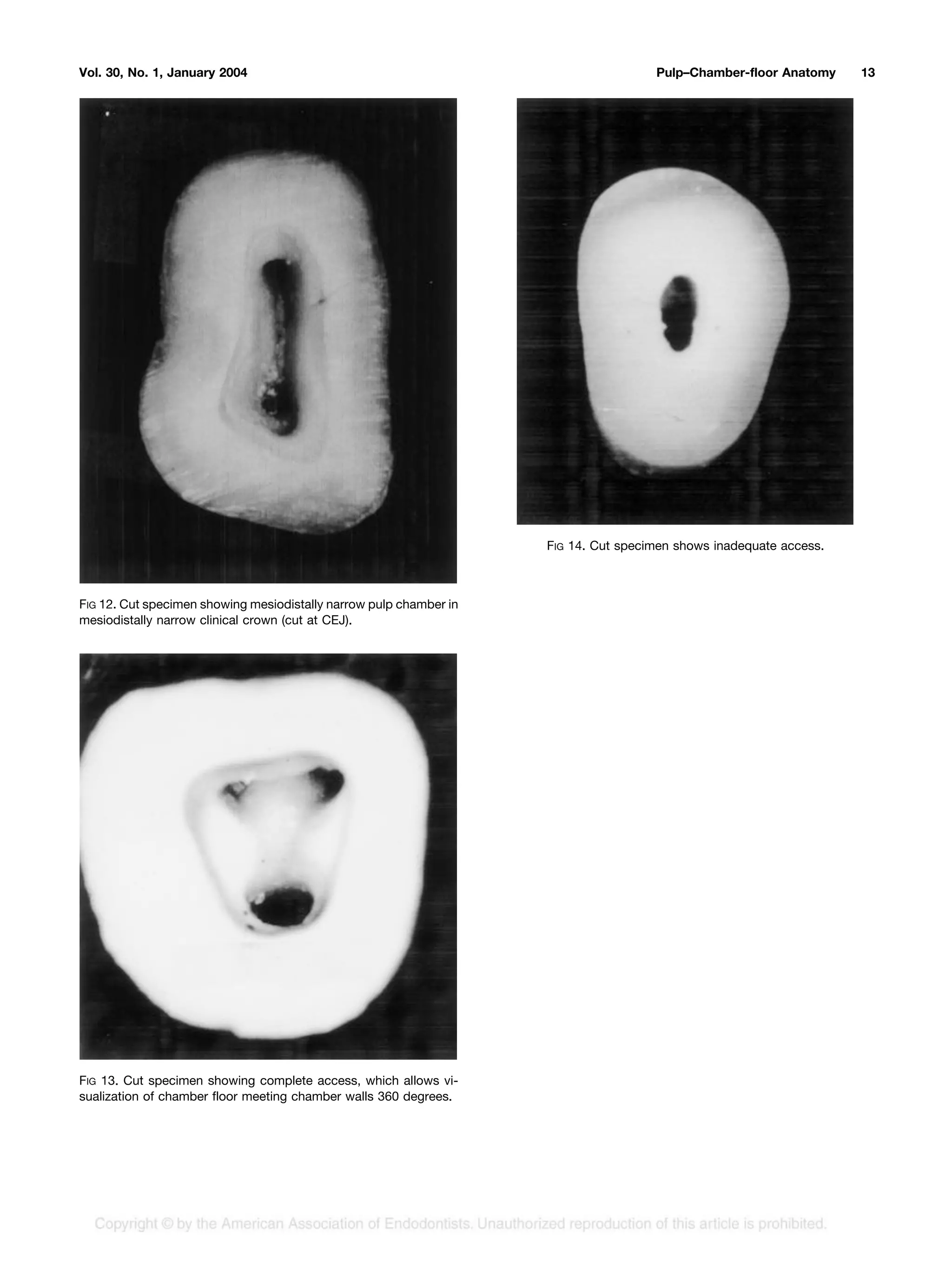 Anatomy of the Pulp-Chamber Floor | PDF
