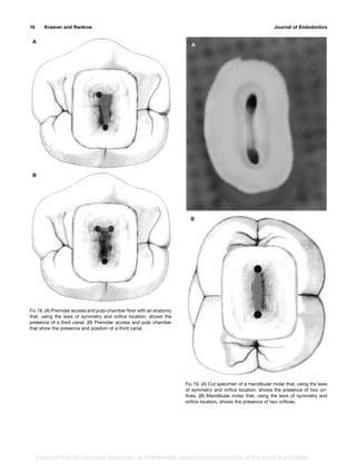 Anatomy of the Pulp-Chamber Floor | PDF