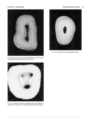 Anatomy of the Pulp-Chamber Floor | PDF