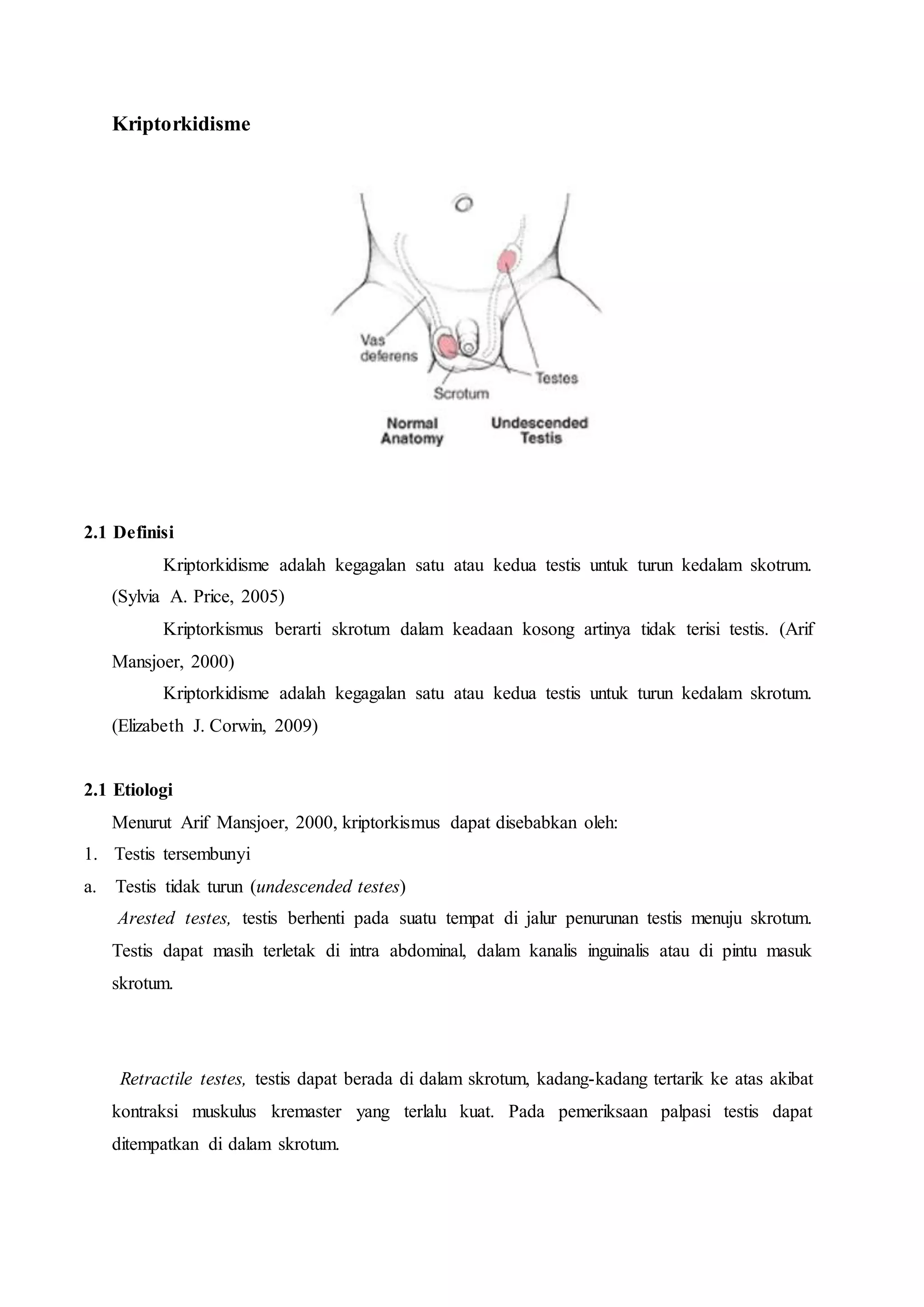 Kriptorkidisme | DOCX