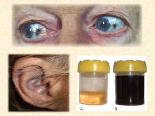 BIOCHEMICAL MUTATION/GENETICS | PPTX