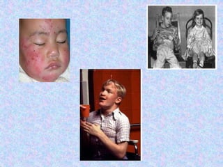 BIOCHEMICAL MUTATION/GENETICS | PPT