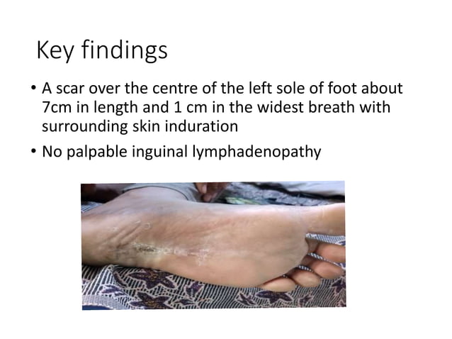 Krishnaraj Synovial Sarcoma Sharanya Pptx Foot Health Diseases And Conditions