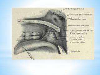 acute tonsillitis | PPTX