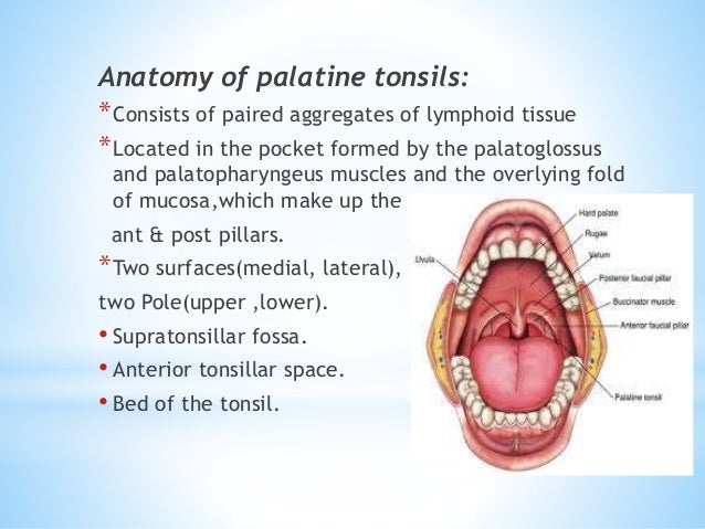 acute tonsillitis